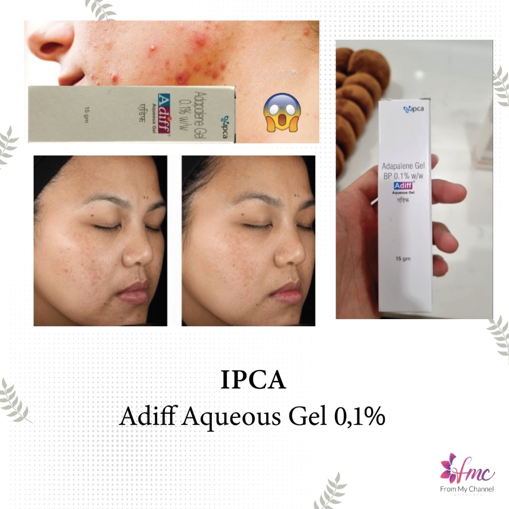 Kem điều trị Adiff Aqueous Gel 15g IPCA | fmccosmetics.com.vn